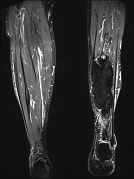 X-Ray: Soft Tissue Evaluation - Illinois Chiropractic Society