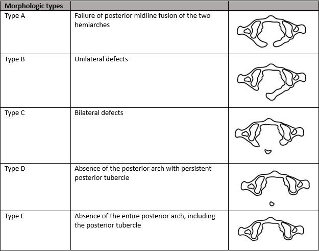 Congenital Hypoplasia of the Posterior Arch of the Atlas: Radiographic ...